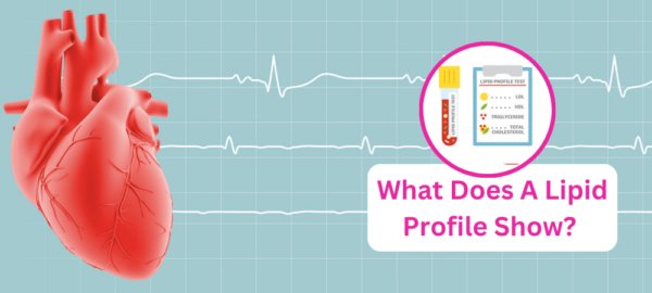 What does a lipid profile show? - Use & Importance