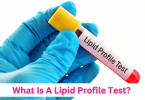What does a lipid profile show? - Use & Importance