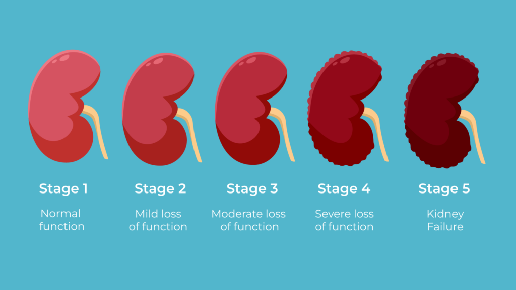 What Are The 5 Stages Of Chronic Kidney Disease Grace Medical
